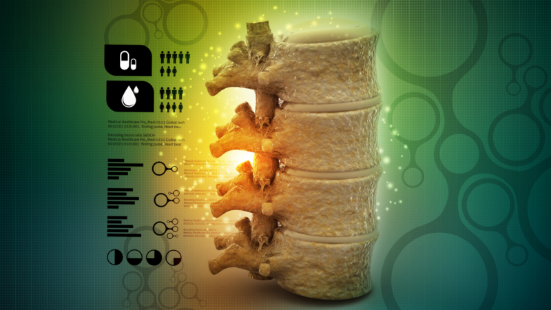 SCS therapy Archives - Precision Spine Care