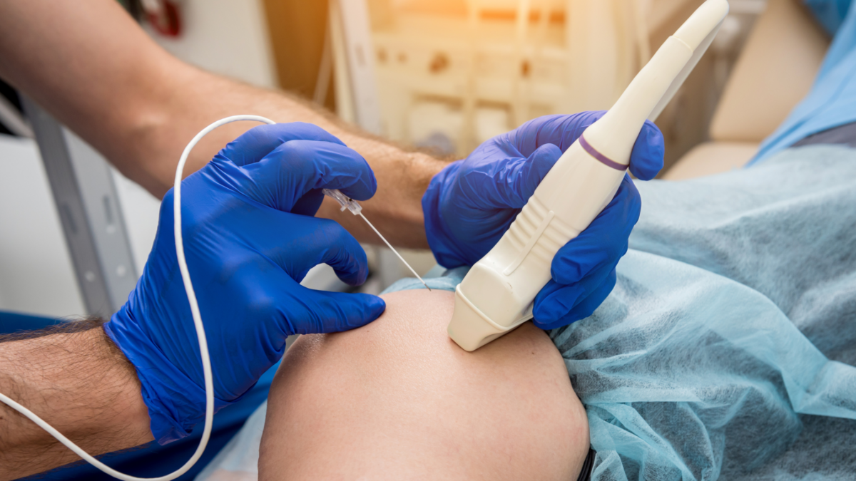 How Does Radiofrequency Ablation Treat Chronic Pain? - Precision Spine Care