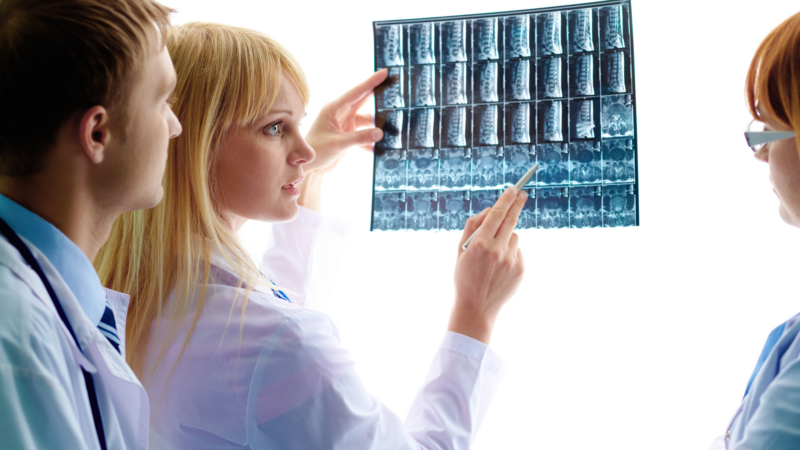 Compression Fractures: The Facts | Precision Spine Care
