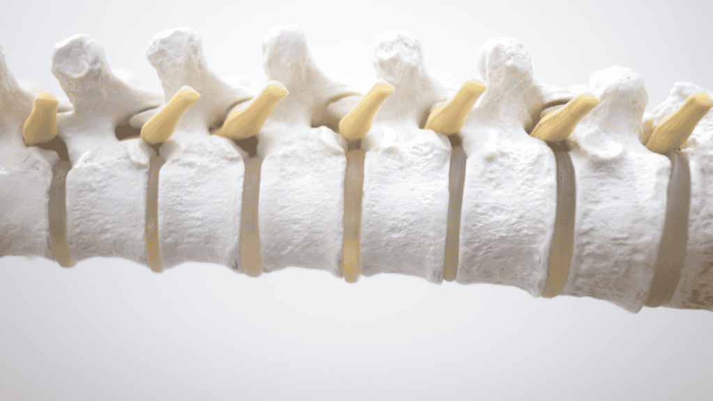 Osteoporosis & Spinal Fractures | Precision Spine Care