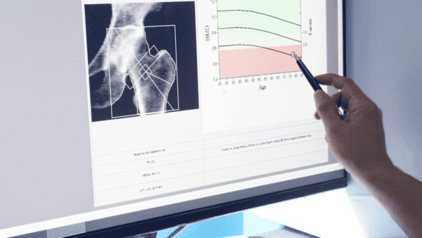 Bone Density Study 101: Everything You Need to Know - Precision Spine Care