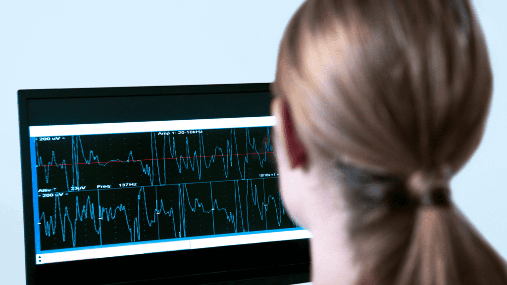 Exploring the Advantages of an Electromyogram (EMG) - Precision Spine Care