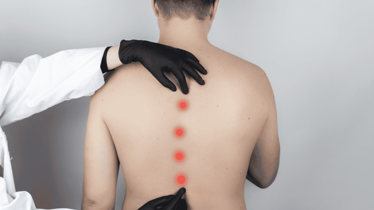 Correcting Spinal Deformities: Effective Treatments - Precision Spine Care