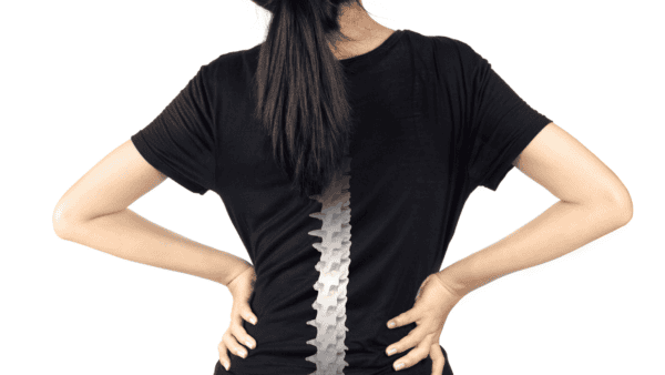 Understanding the Cause and Treatment of Bone Spurs - Precision Spine Care