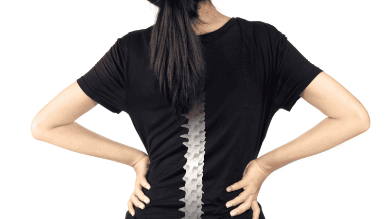 Understanding the Cause and Treatment of Bone Spurs - Precision Spine Care