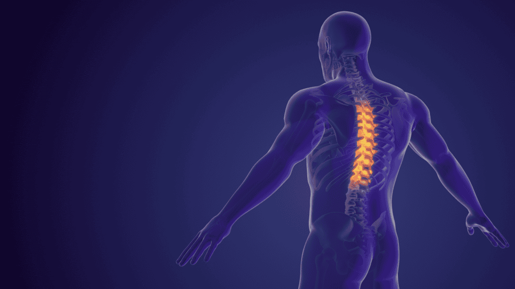 Common Spinal Deformities and How They are Managed - Precision Spine Care