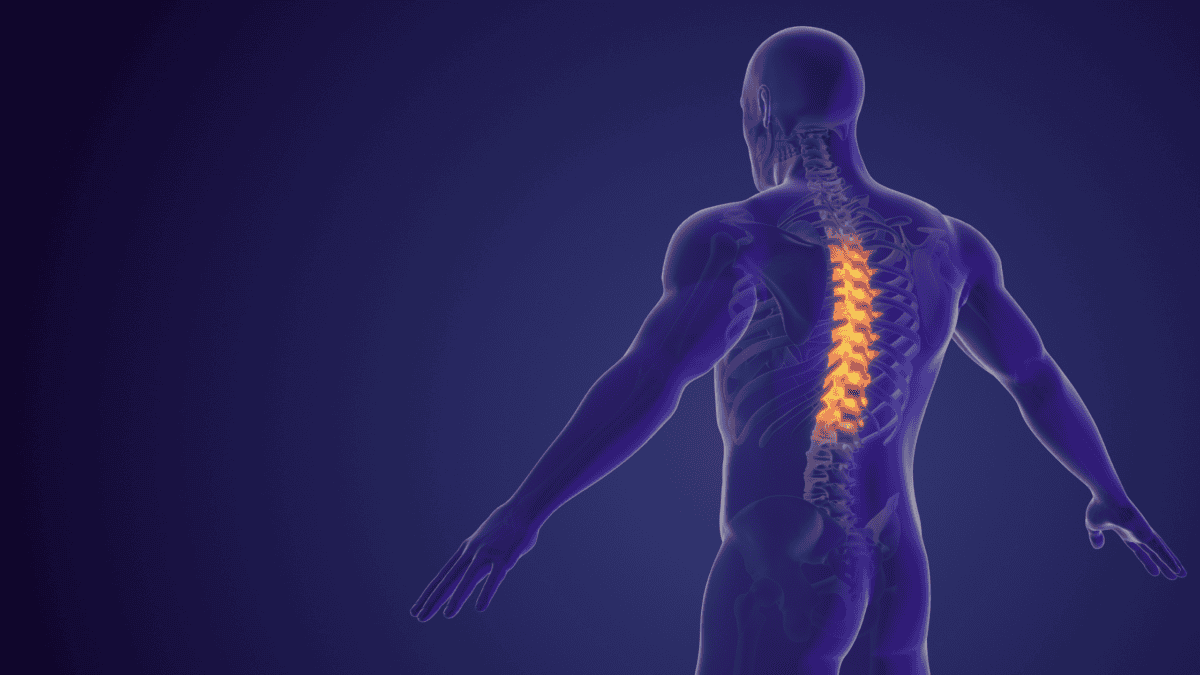 Common Spinal Deformities and How They are Managed - Precision Spine Care