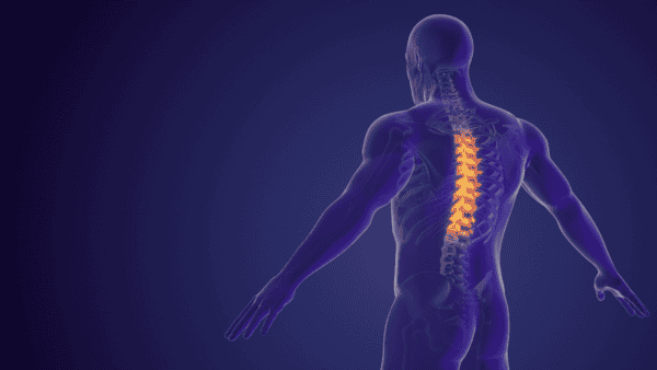 Common Spinal Deformities and How They are Managed - Precision Spine Care