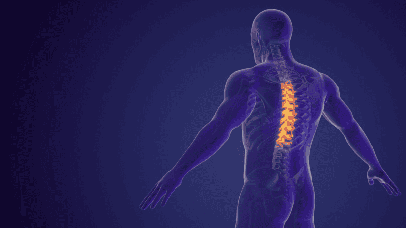 Common Spinal Deformities and How They are Managed - Precision Spine Care