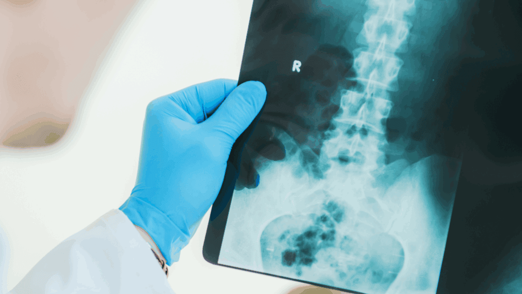 How Diagnostic Imaging Guides Your Spine Treatment Plan - Precision ...
