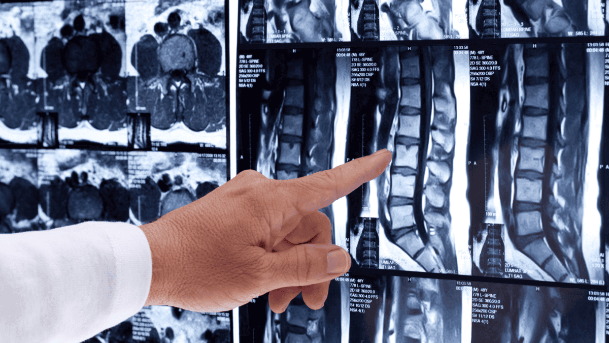 Imaging Tools for Diagnosing Back Problems - Precision Spine Care